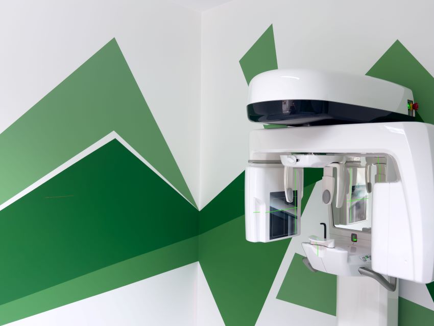 Board Mounted Laser Assembly Case Study - Prophotonix